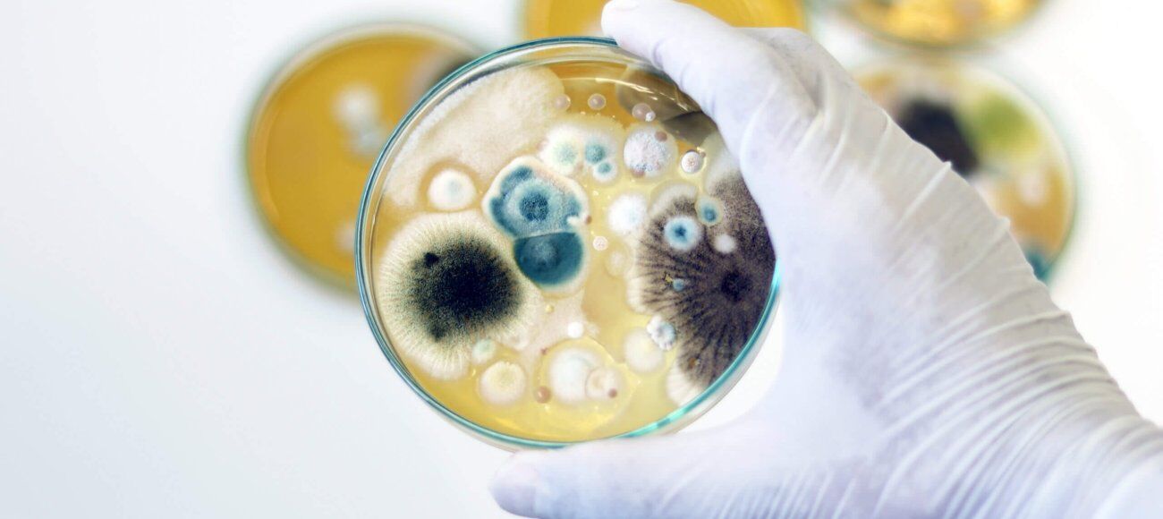 DIY or Professional? Fungal Testing Kits for Home vs Lab